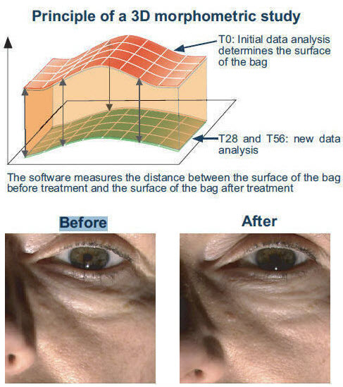 Bellahut EYELISS™ With Eyeliss™ Concentrate